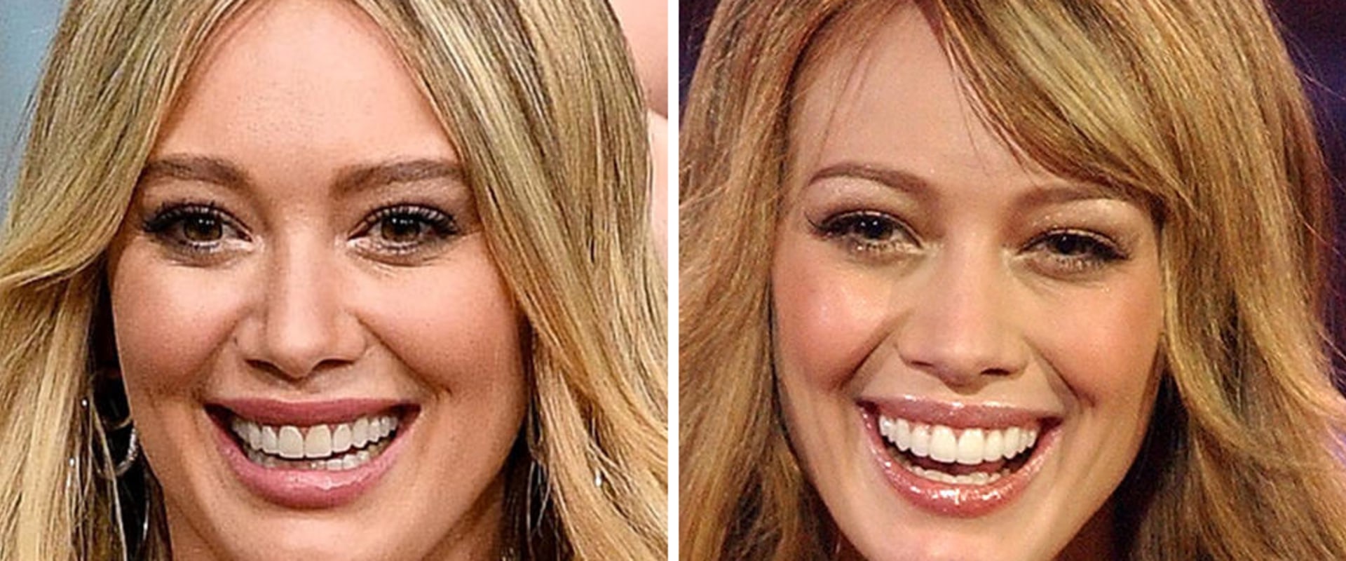 Celebrities' Smile Secrets: What Dental Procedures Do They Use?